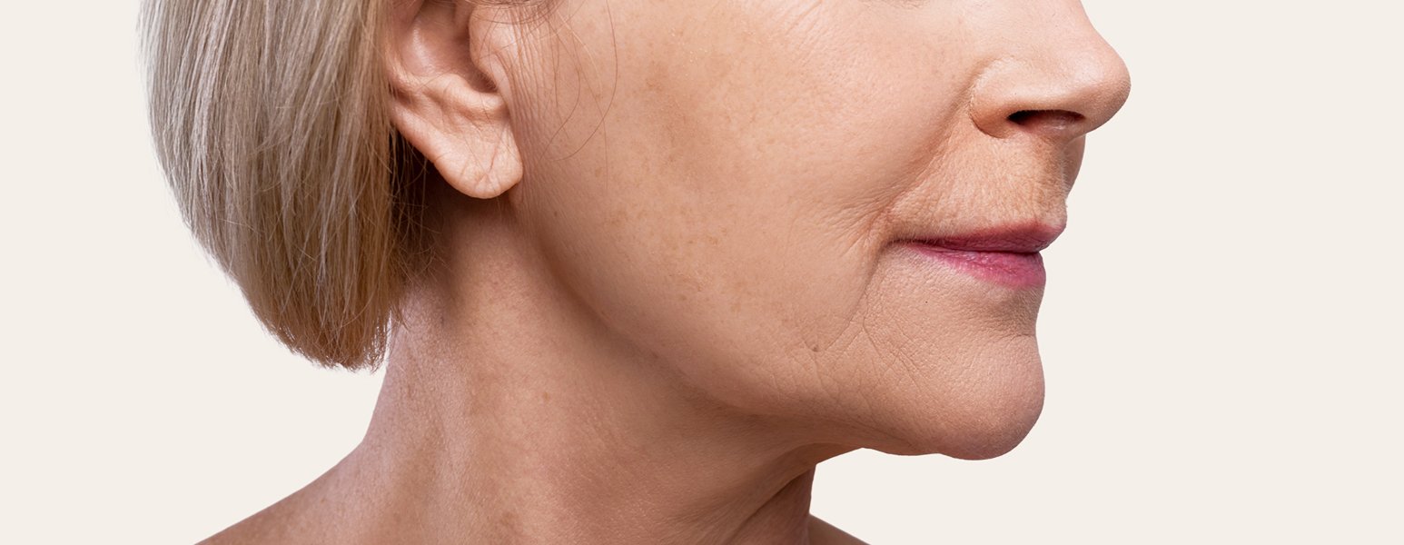 Perioral lines and smoker’s lines - Clinique One Skin