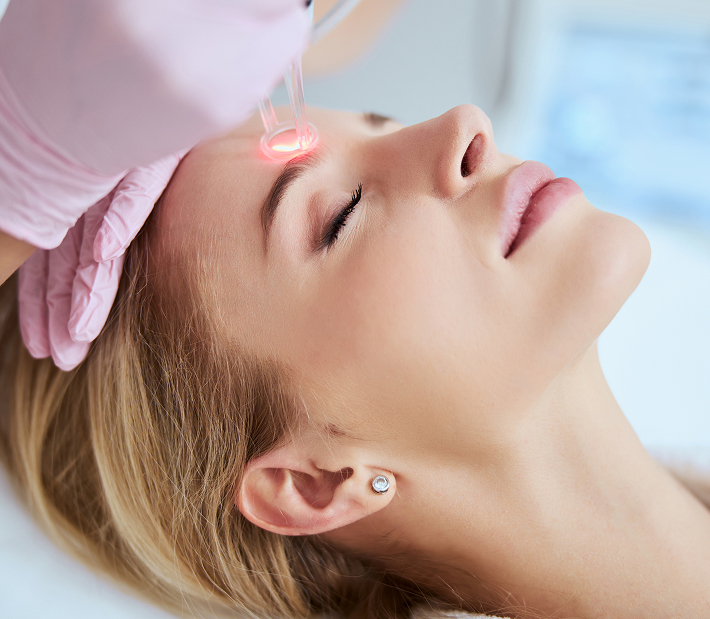 CO2 Laser in Laval | Fractional Resurfacing at Clinique One Skin™